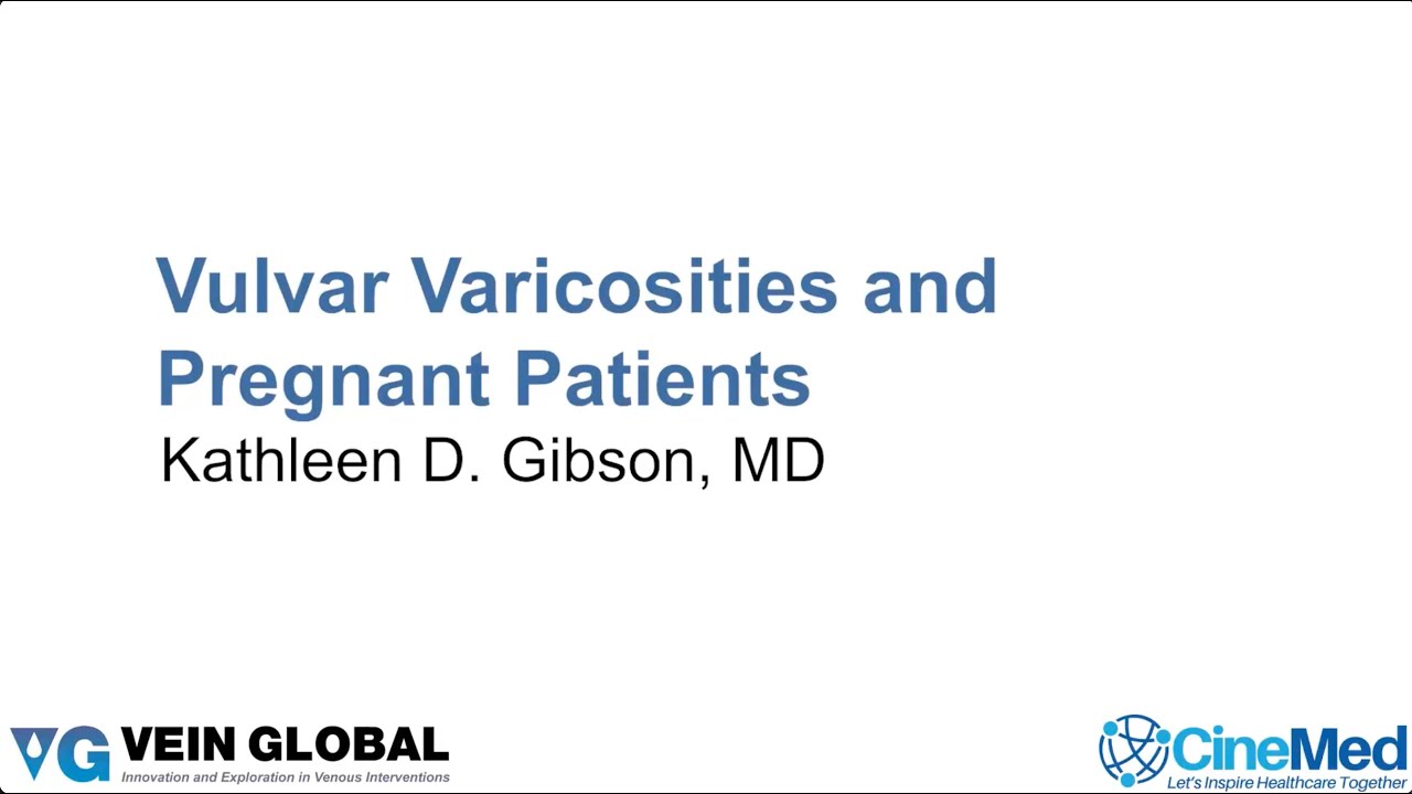 Vulvar Varicosities and Pregnant Patients | IVC Miami - YouTube
