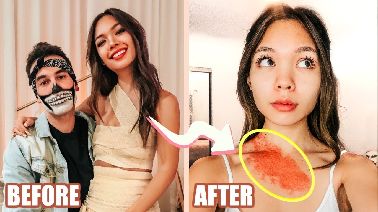 My Halloween Costume BURNED Me! (with PICTURES!) - YouTube