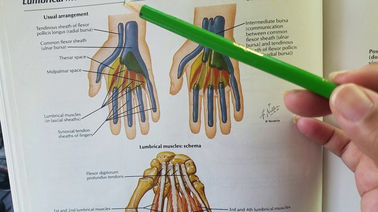 Anatomy infection of the hand, spread of infection in the hand (lec 4 ...