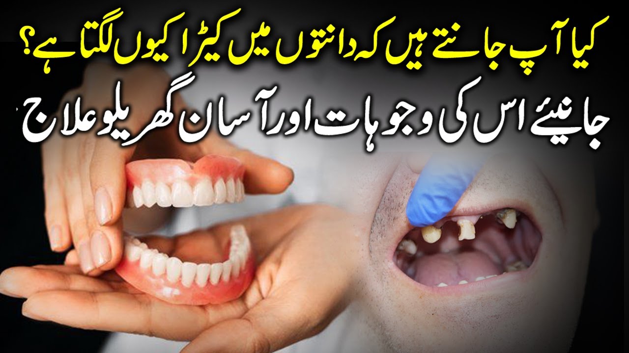 Do you know why tooth decay occurs? - YouTube