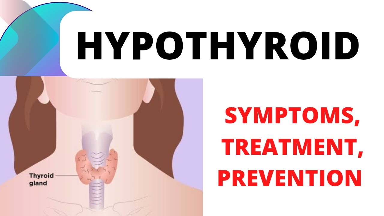 Hypothyroidism Symptoms And Treatment Hypothyrotism Hypothyroid
