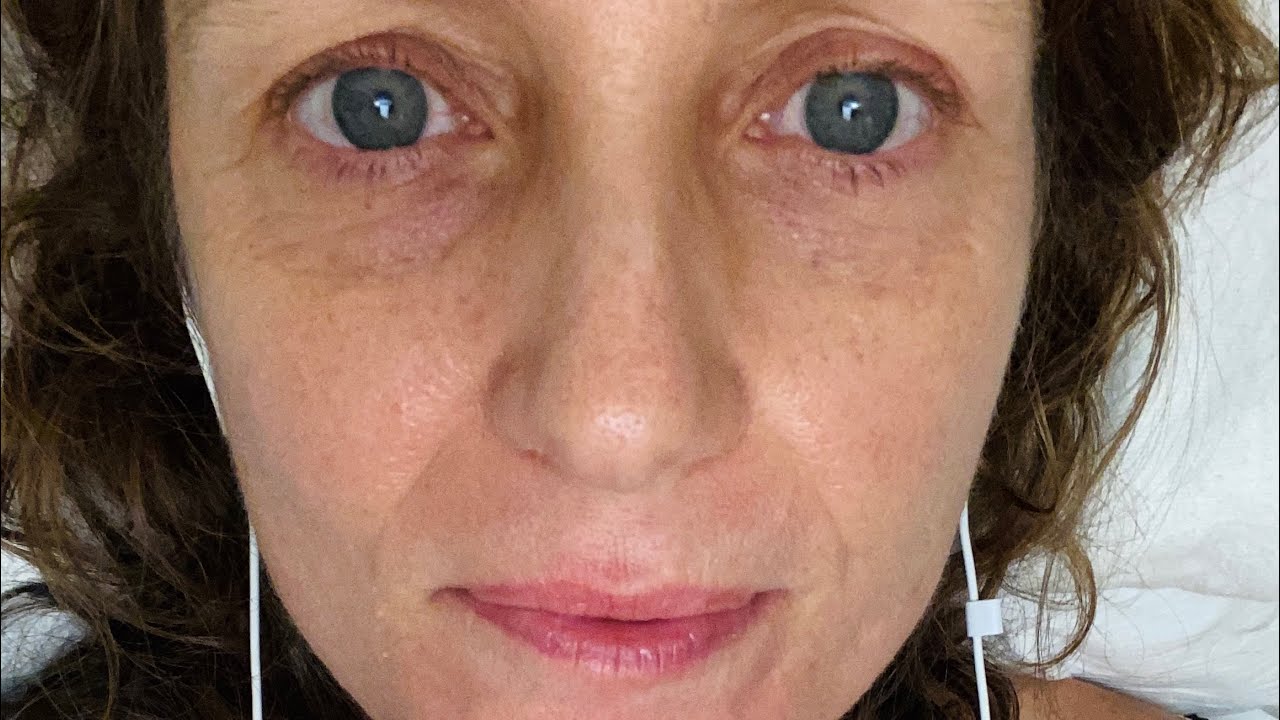 #98 ...24 Hours after ‘Flat Closure’ Surgery (flat surgery site reveal ...