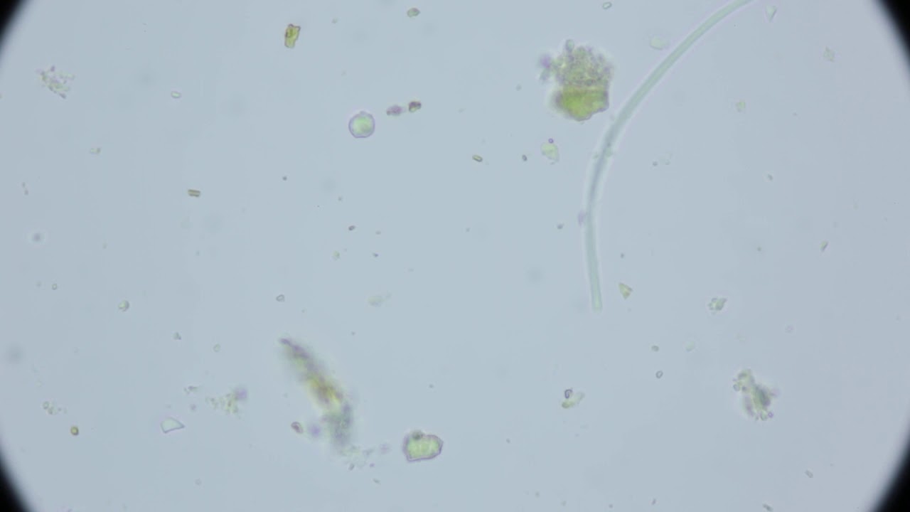 Antarctic Bacteria (200x) from Lake Bonney Upland Ponds Microbial Mat ...