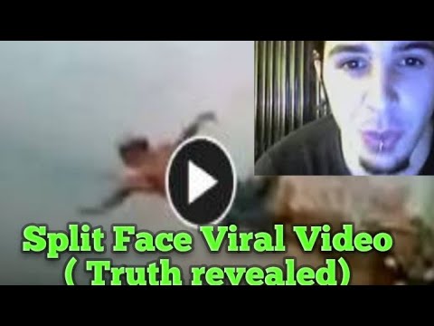 split face diving accident | diving face split | face split diving accident video |split face ...