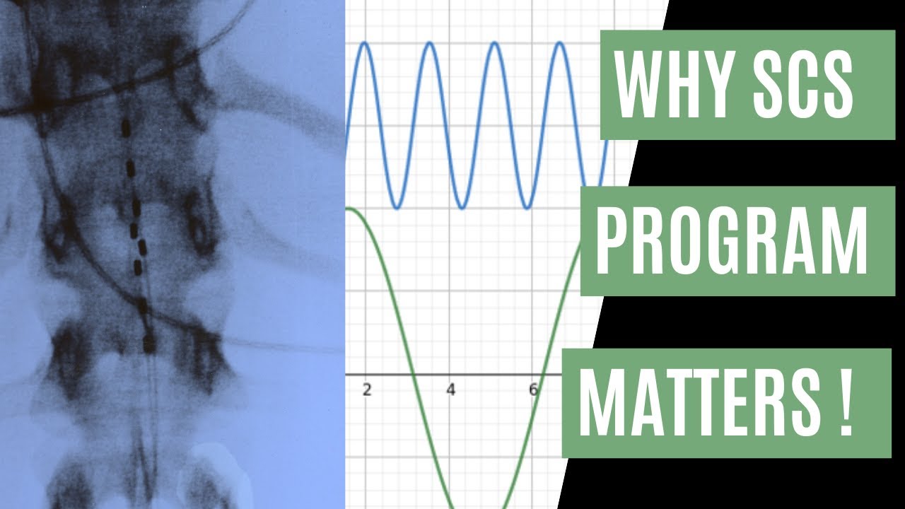 Why SCS Programming Matters: Understanding How To Relieve Pain Through ...