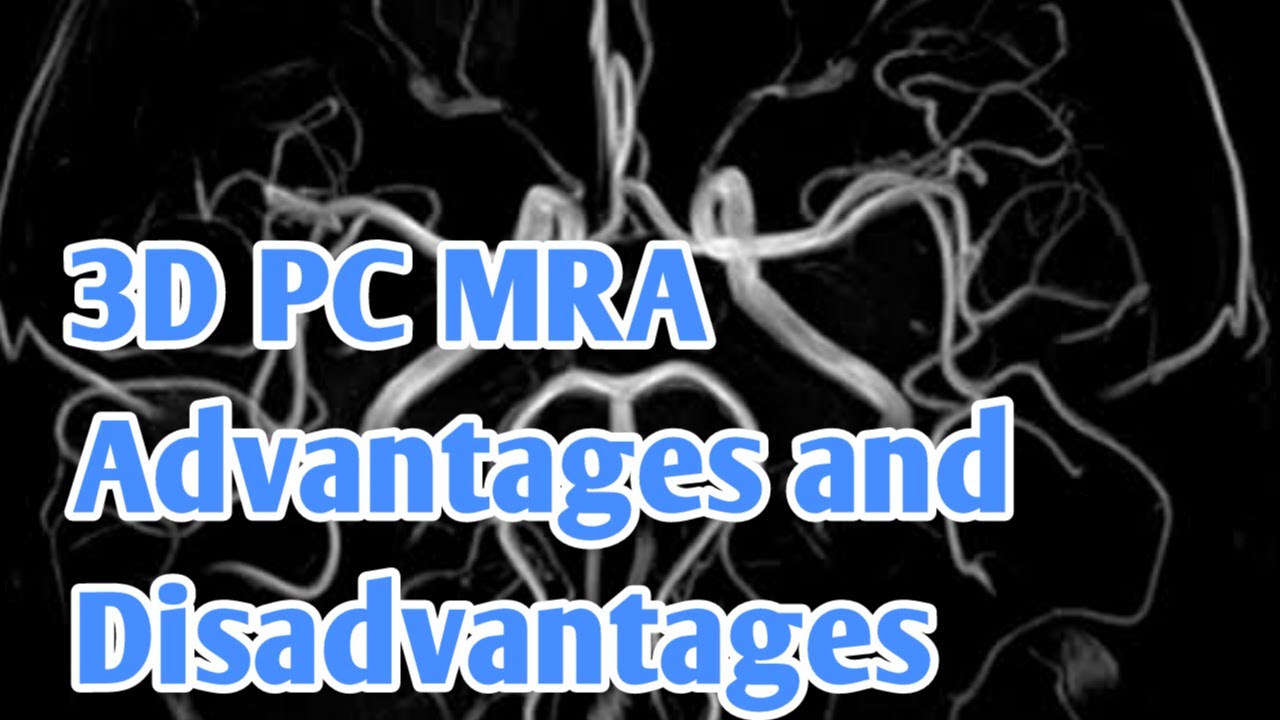 3D PC MRA Advantages and Disadvantages sk rad tech - YouTube