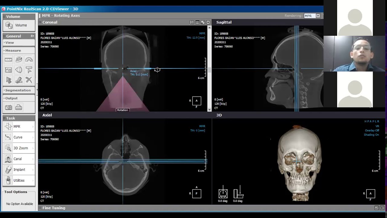 Herramientas Básicas del Real Scan - YouTube