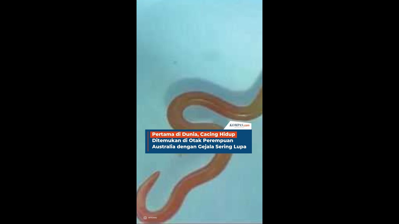 Pertama di Dunia, Cacing Hidup Ditemukan di Otak Perempuan Australia ...