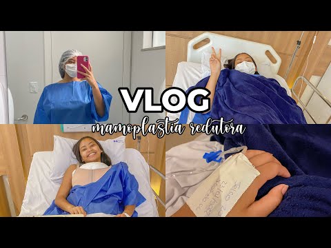 VLOG: fiz uma mamoplastia redutora | Diário da cirurgia #2