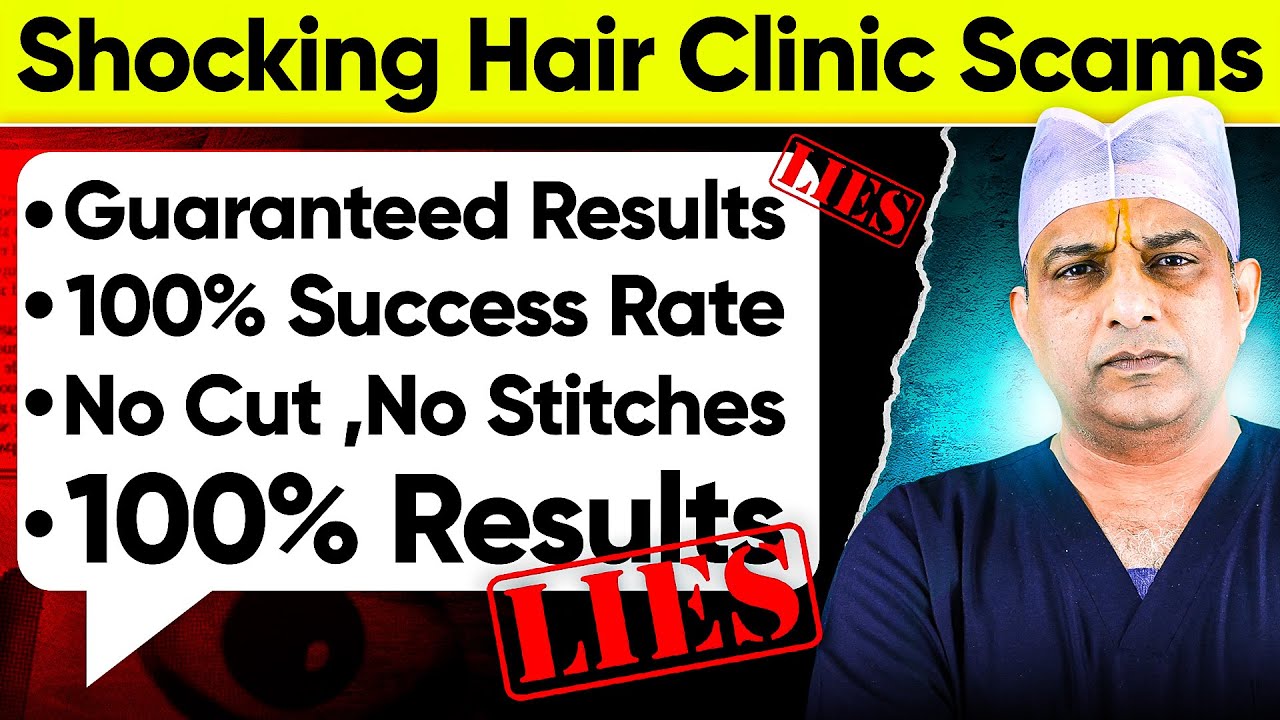7 Biggest Lies Hair Clinics Tells You: Real Scam Exposed - YouTube