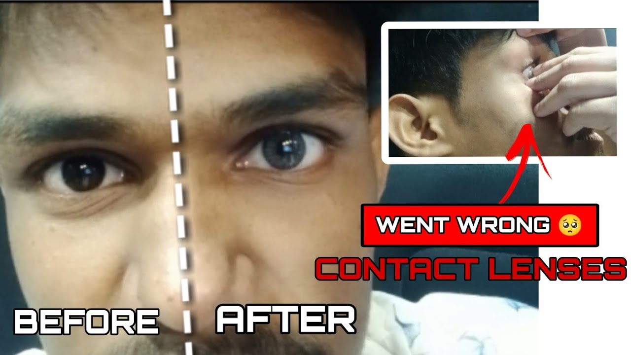How to use Contact lenses | Trying contact lenses went wrong 🥺 | # ...