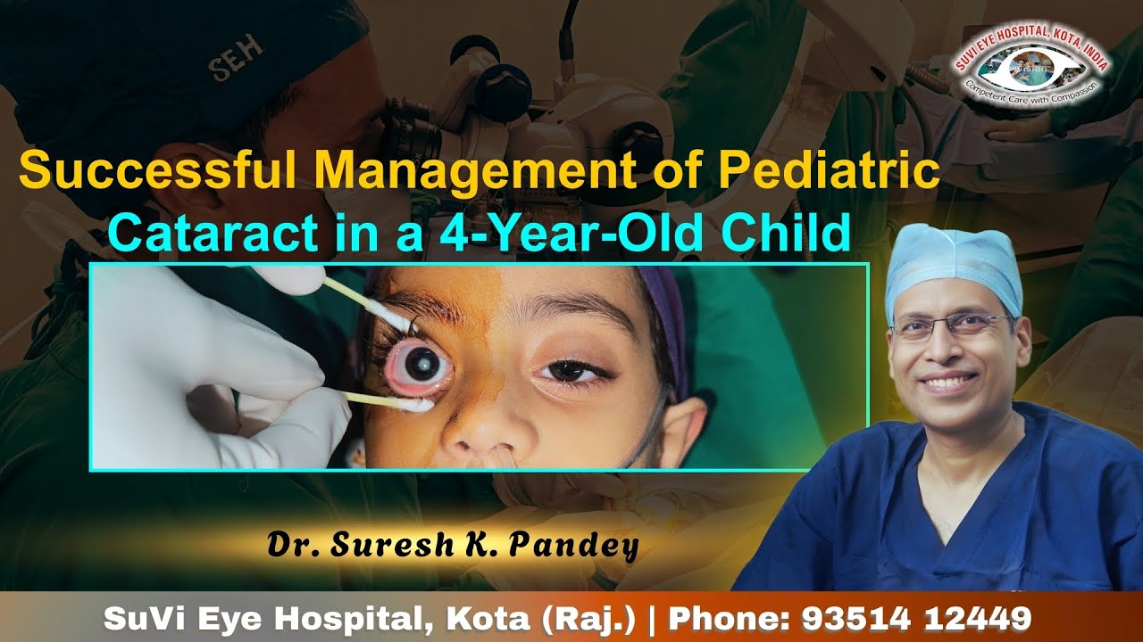 Successful Management of Pediatric Cataract in a 4-Year-Old Child at ...