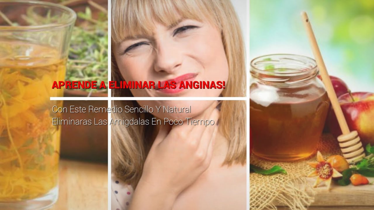 Aprende A Desinflamar Las Amigdalas O Anginas De Forma Sencilla Y 100% ...