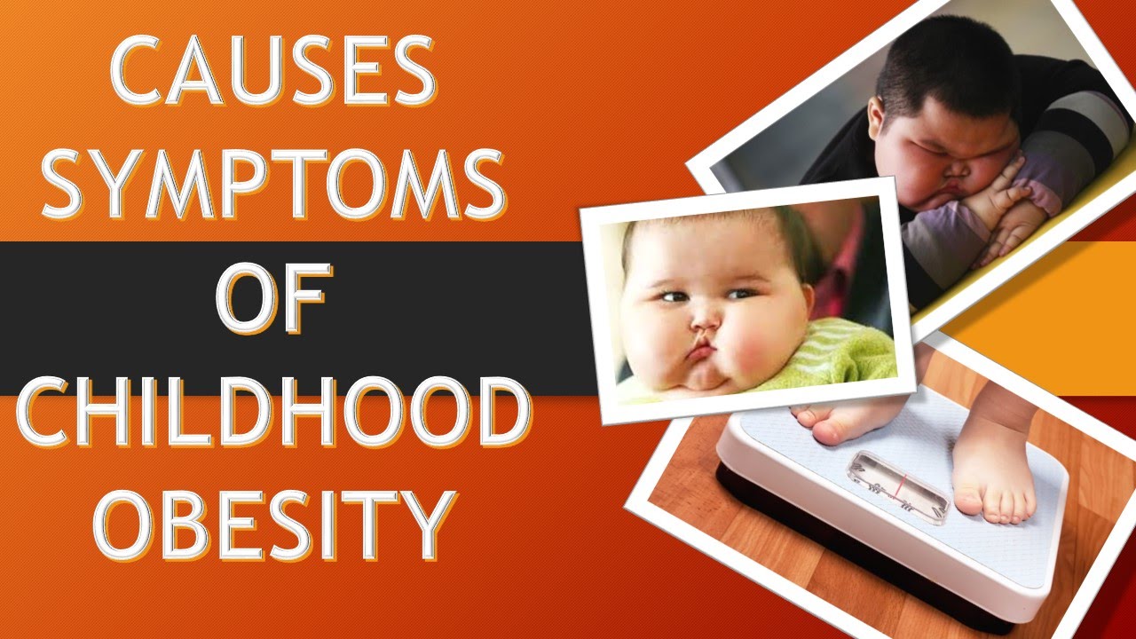 CAUSES SYMPTOMS OF CHILDHOOD OBESITY AND PREVENTION - YouTube