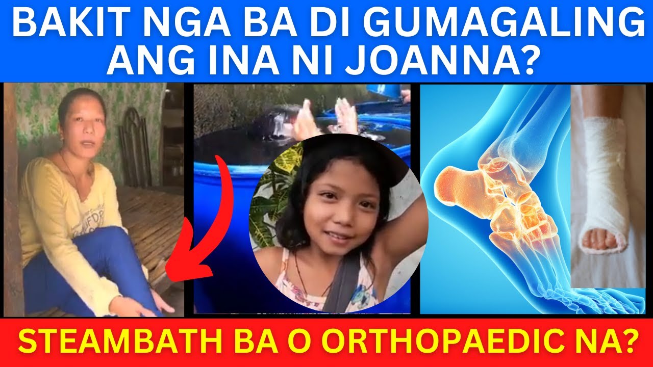 MAMA NI JOANNA BAKIT MASAKIT PARIN ANG PAA? | MAKUKUHA KAYA SA STEAM ...