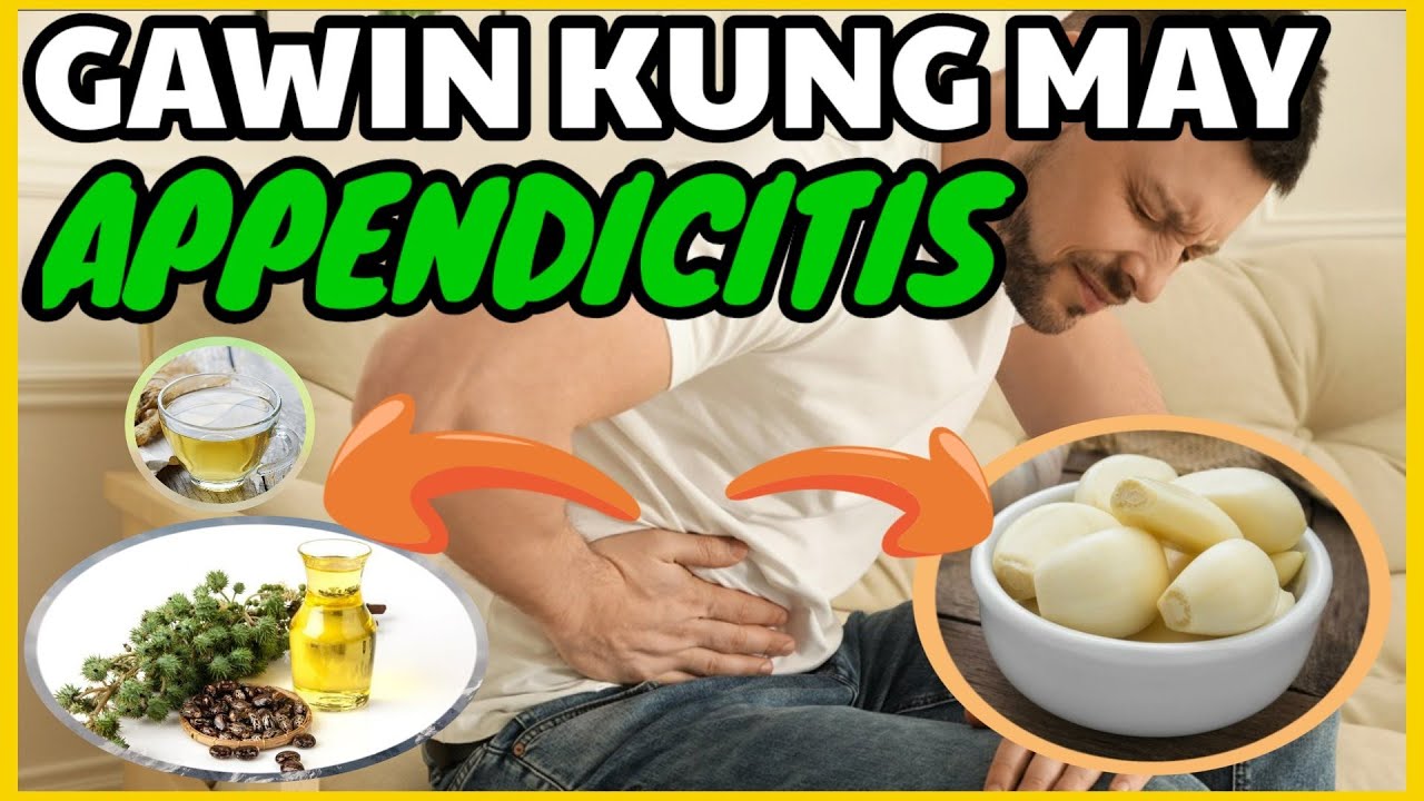 Ang Pwedeng Gawin Kung NAKAKARANAS Tayo Ng APPENDICITIS.! | Kontra ...