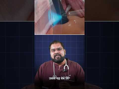 Shockwave therapy for erectile dysfunction - is it painful?