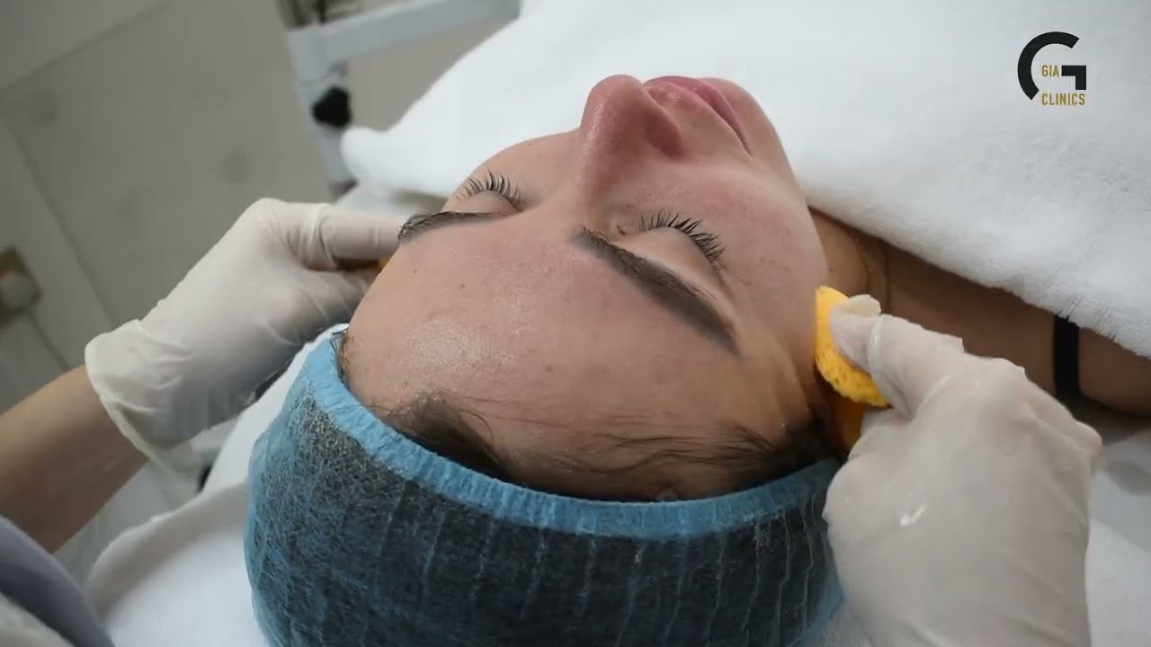 MesoGold Microinfusion Facial - YouTube