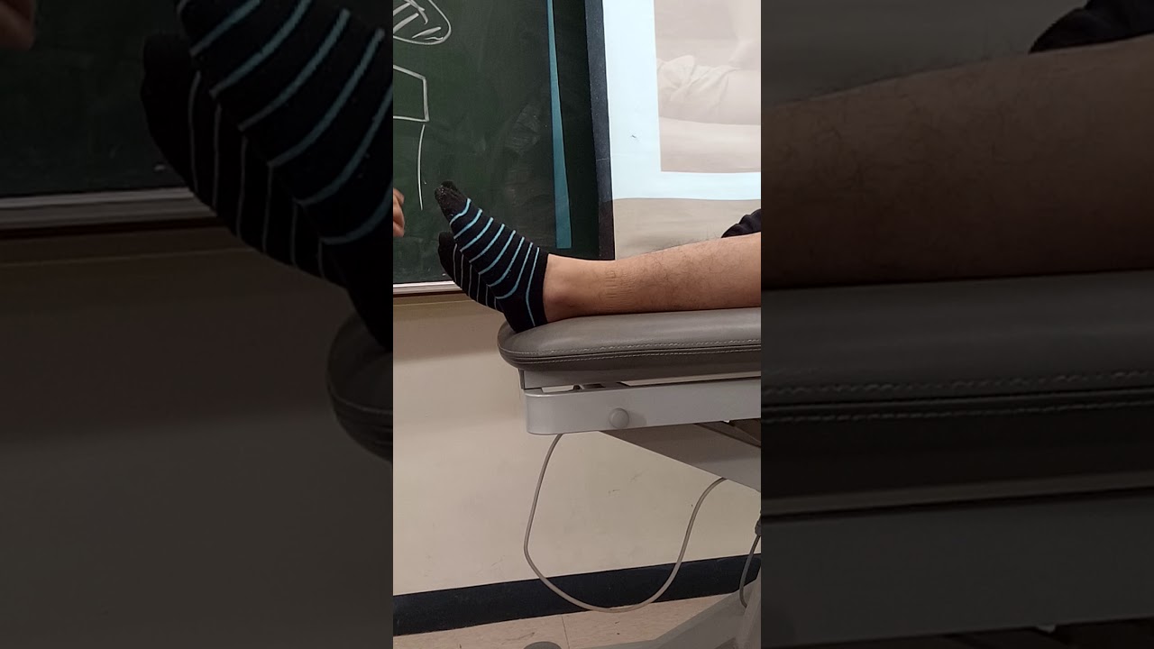 霍曼徵象Homan's sign - YouTube