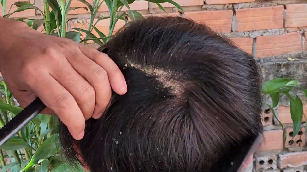 ASMR Scalp Scratching for Sleep and Relaxing Care #442 - YouTube