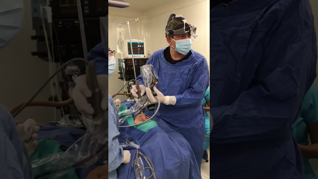 Turbinoplastia endoscopica - YouTube