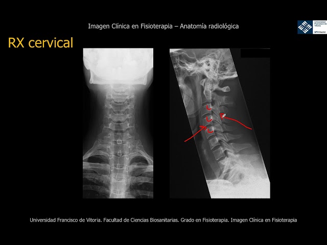 Anatomía De La Radiografía Lateral Del Cuello Cómo Leer Una