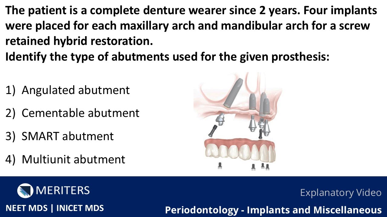 NEET MDS | INICET - Periodontics - Implants and Miscellaneous ...