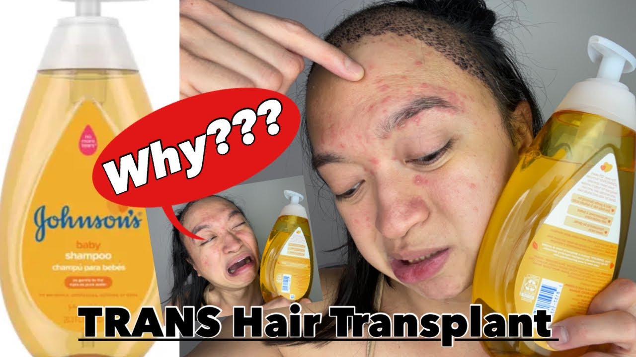 WHY I STOPPED USING JOHNSON’S BABY SHAMPOO | TRANSGENDER HAIR ...
