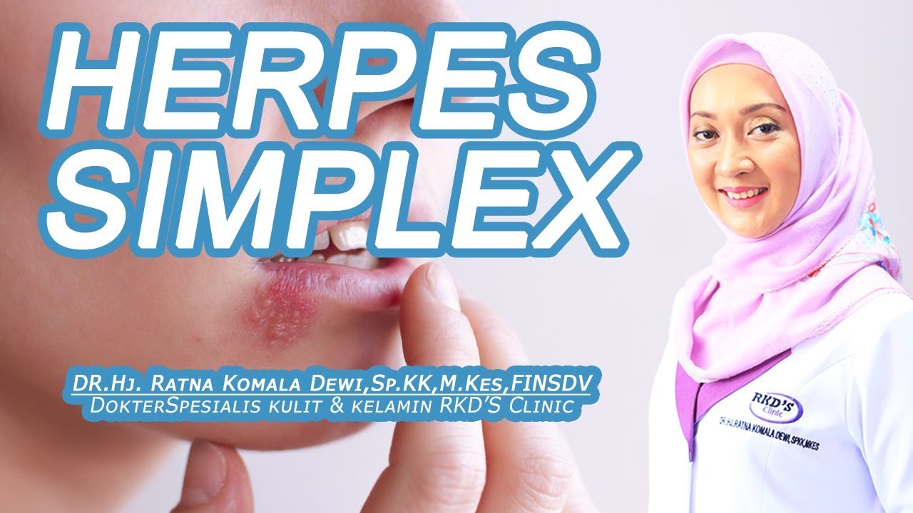 Herpes Simplex? Ini Cara Menyembuhkannya! - YouTube