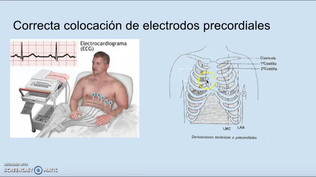 Tecnica de realizacion de un electrocardiograma - YouTube