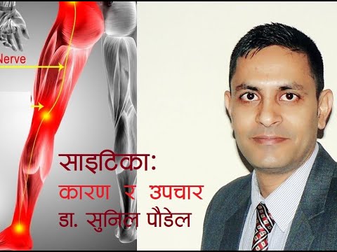 साइटिका कारण र उपचार, Sciatica, Dr. Sunil Paudel; बिना अप्रेसन - YouTube