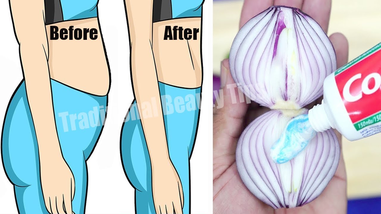 Just Apply it Before Bedtime & Burn Fat Overnight, In 3 Days Loss Your ...