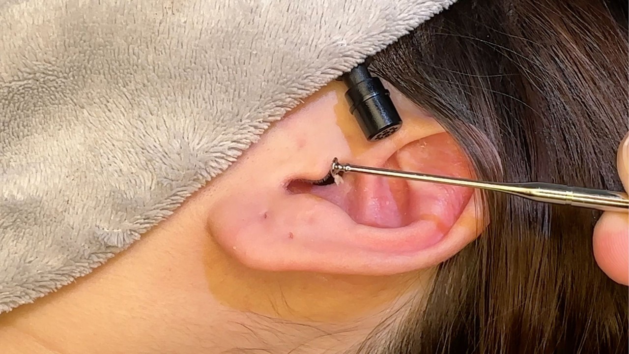 ASMR Ear Cleaning | Every Wax Pull Gets More Satisfying - YouTube