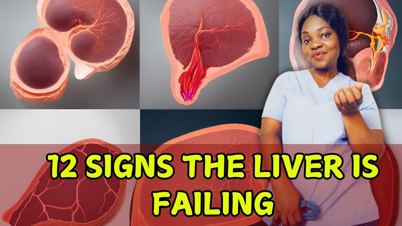 12 SIGNS THE LIVER IS FAILING - YouTube