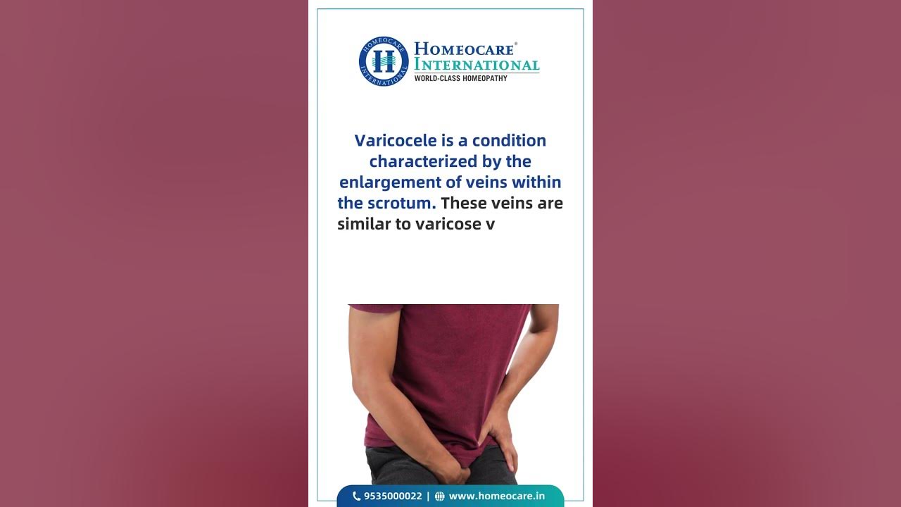 How Homeopathy Helps To Manage Varicocele Symptoms Youtube