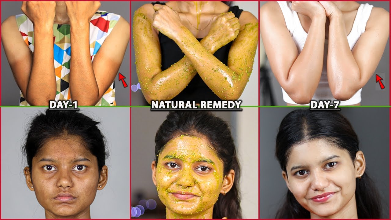 Remove TANNING At Home In 7 DAYS NATURALLY | Remove OLD TAN & Get ...