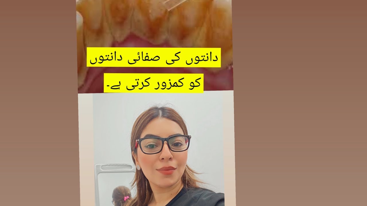 Teeth Cleaning/Teeth Scaling.Good or bad?By Dr Maria Abbaai - YouTube