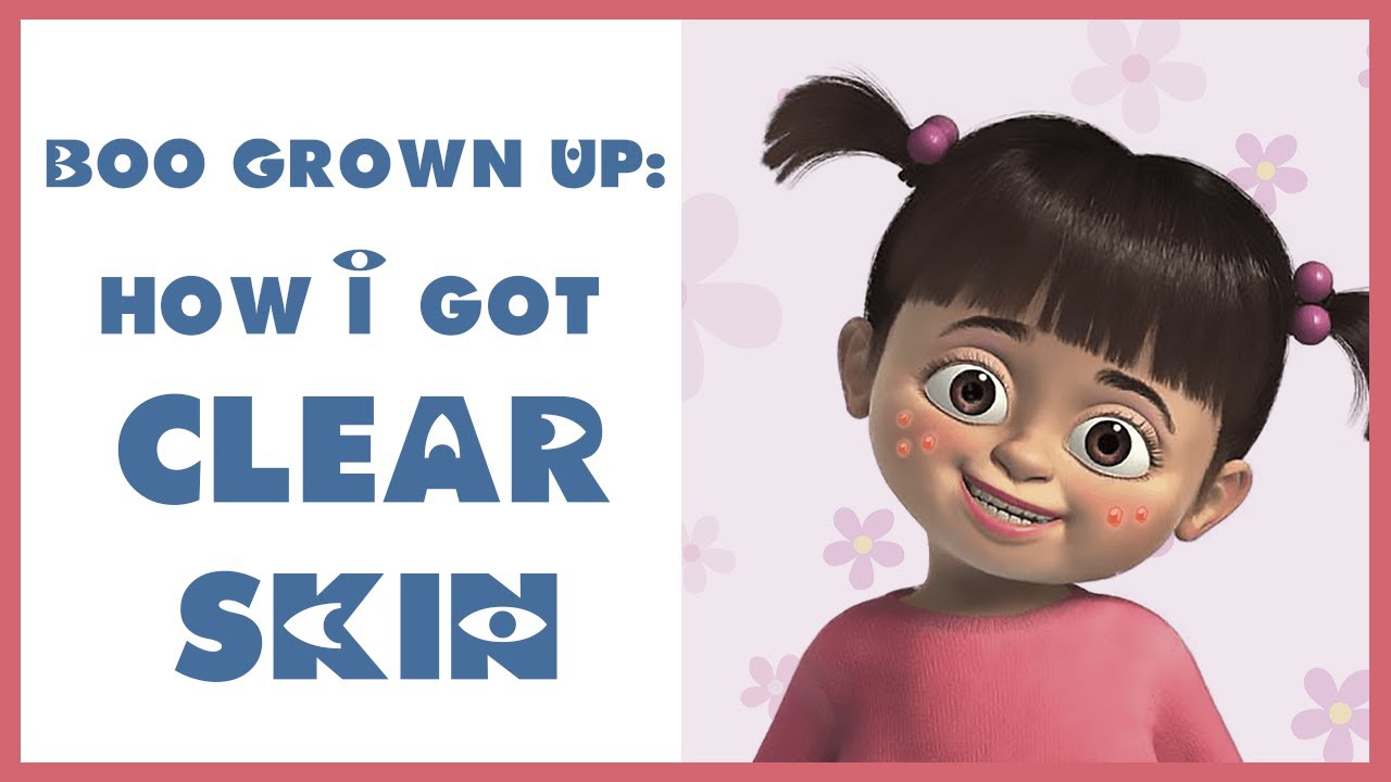Boo Grown Up | How I Got Clear Skin Naturally - YouTube