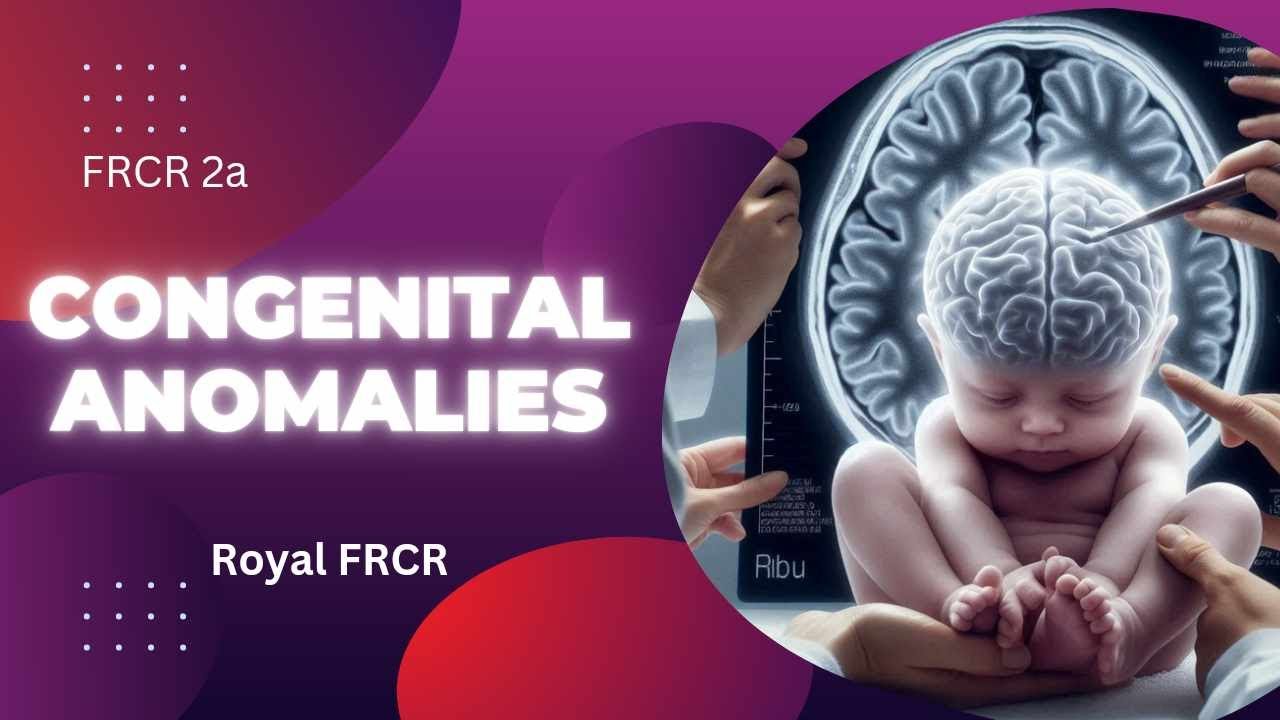 2 - Neuroimaging for FRCR - YouTube