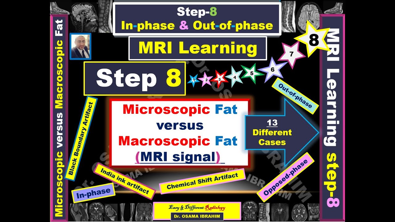 MRI learning 8 - Macroscopic fat Vs Microscopic fat (Opposed-phase) 13 ...