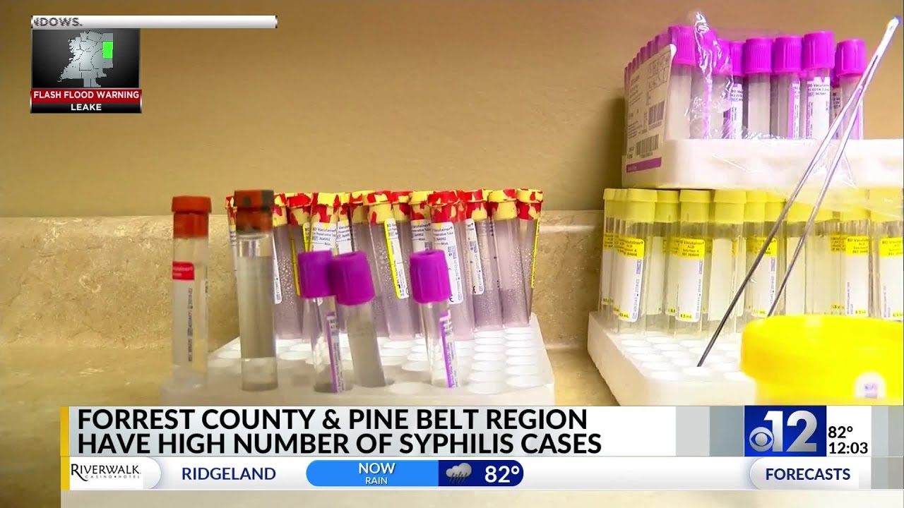 Pine Belt region sees high number of syphilis cases - YouTube