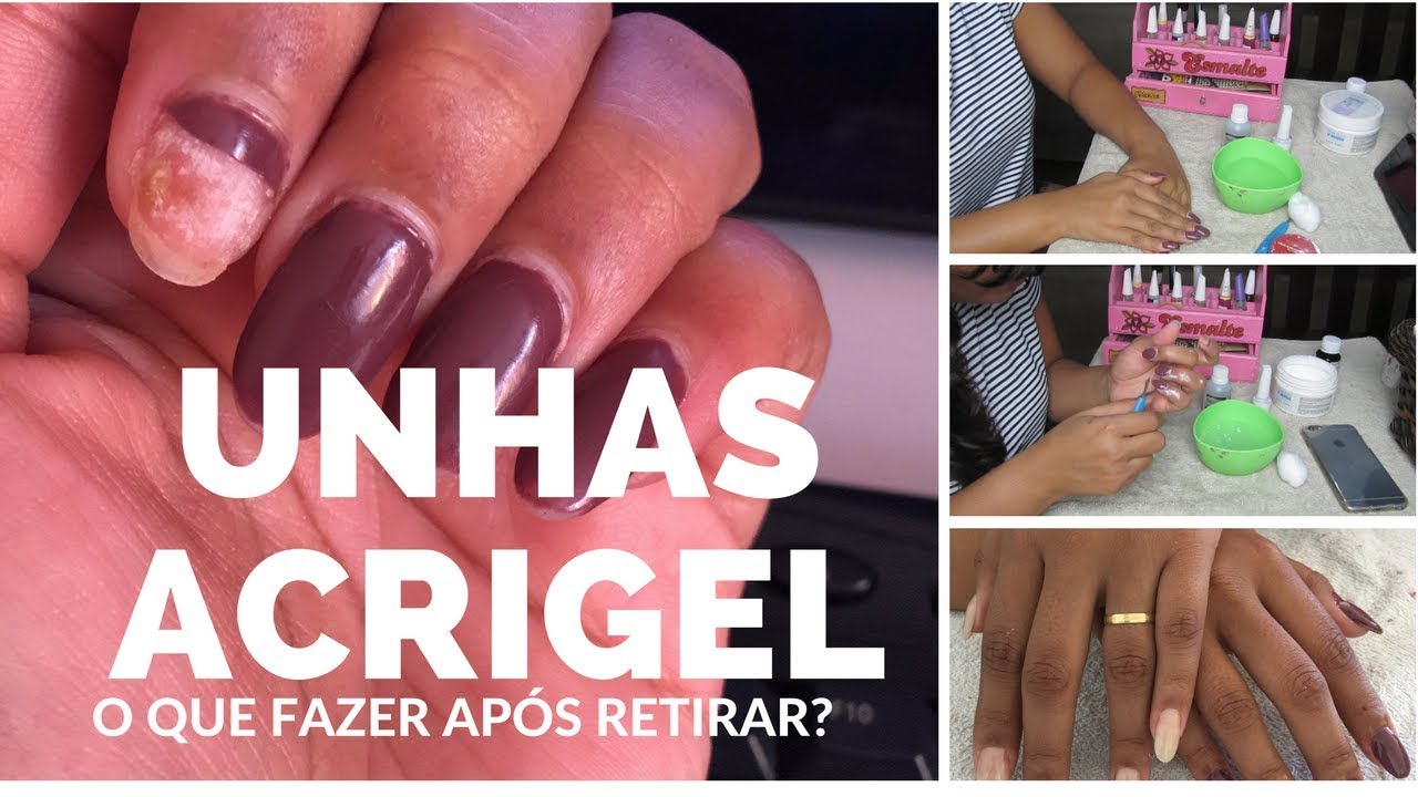 Como retirar as unhas de Acrigel em casa - Começando o Processo de ...