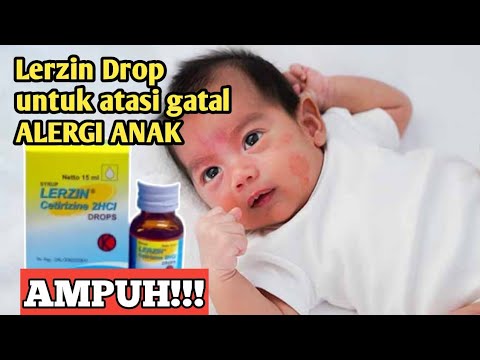 Obat gatal alergi anak lerzin drop