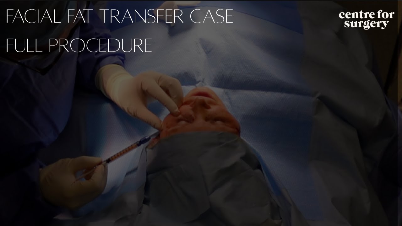 Facial Fat Transfer including Lips by Dr Shehab Jabir FULL PROCEDURE ...