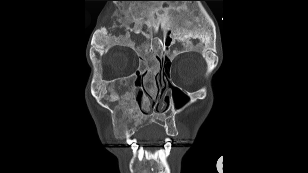 Radiology 5 cases#radiopedia #radiant#toturials #cns#quizzes#frcr#board ...