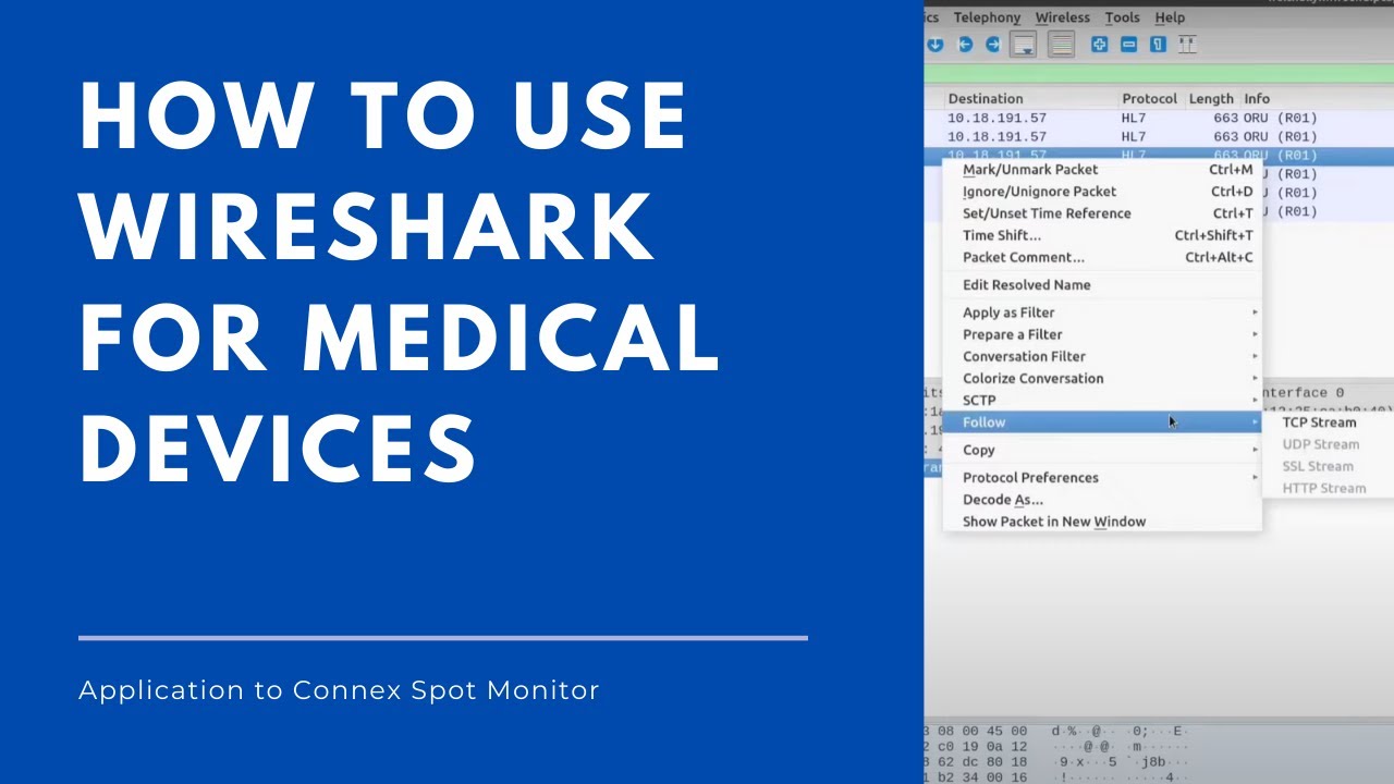 How to use Wireshark for Medical Devices - View Welch Allyn Raw Packet ...