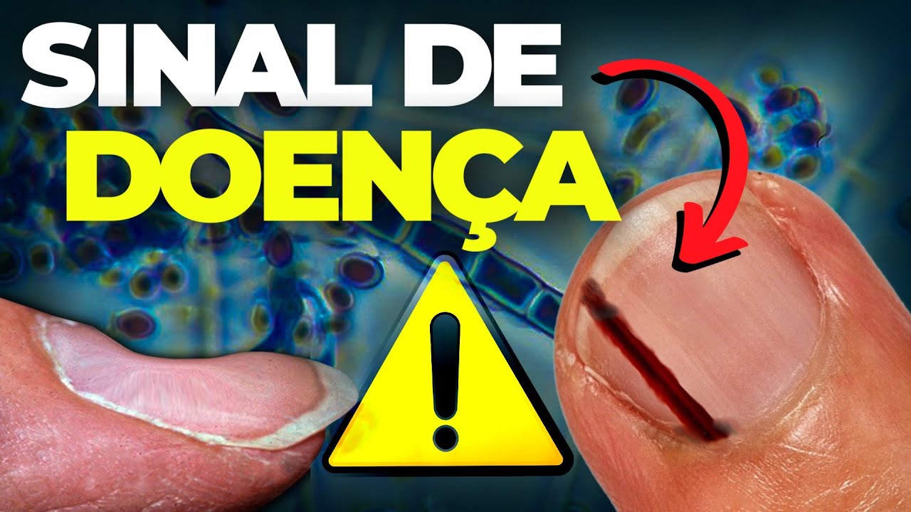 O que as UNHAS REVELAM sobre a sua SAÚDE - YouTube