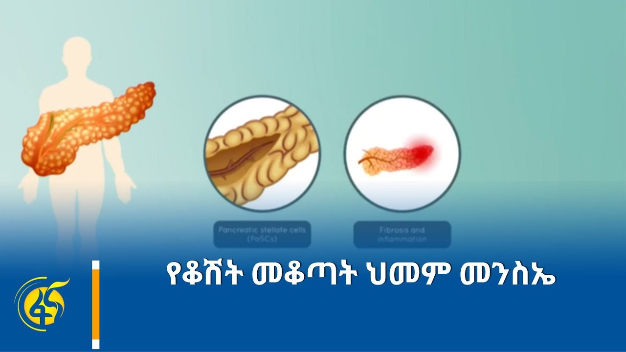 የቆሽት መቆጣት ህመም መንስኤ Youtube
