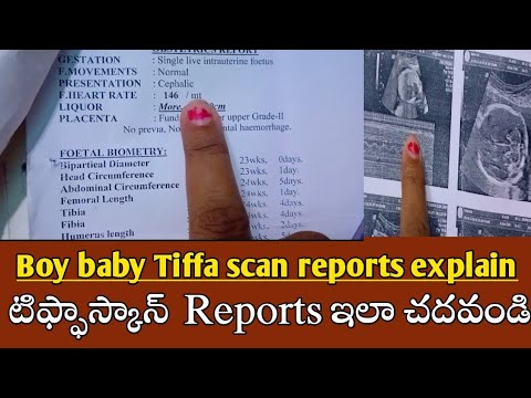 Babyboy6th month tiffa scan reports explain in Telugu|how to read ...