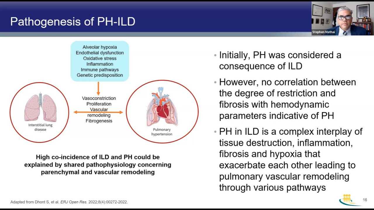Revised Definition Of Pulmonary Hypertension And Approach Revised Definition Of Pulmonary Hypertension And Approach